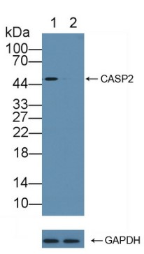 Knockout Validated Antibodies - Creative Diagnostics