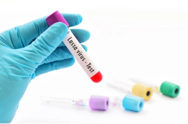 Lassa Virus - Creative Diagnostics