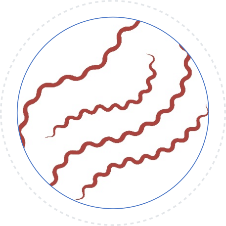 Leptospirosis Testing - Creative Diagnostics