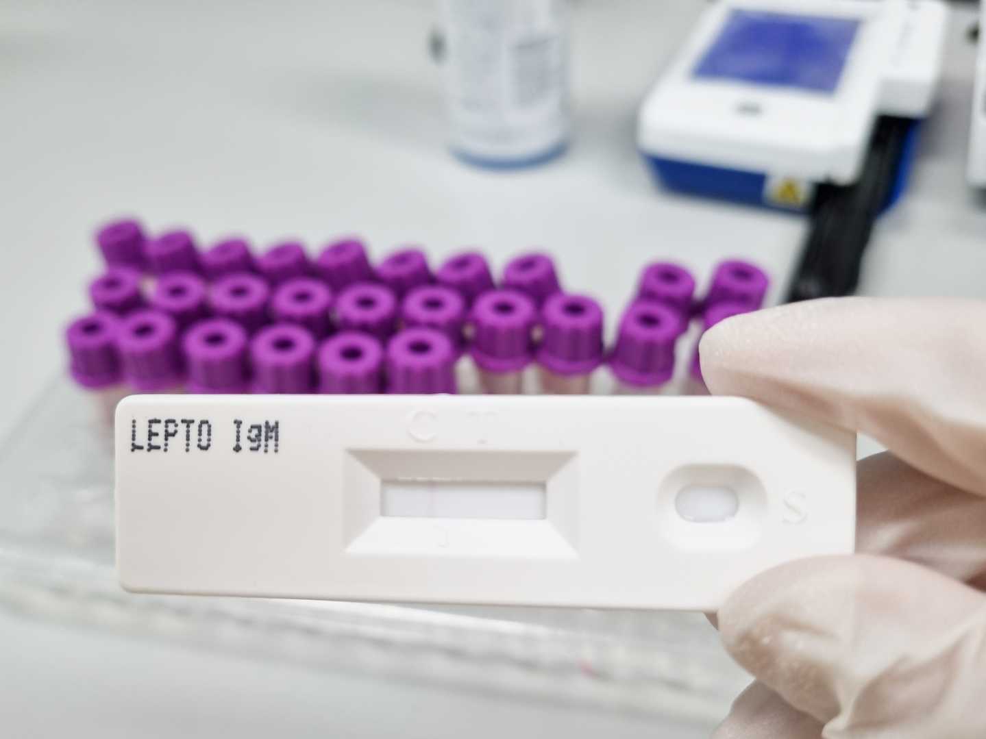 Leptospirosis Testing - Creative Diagnostics