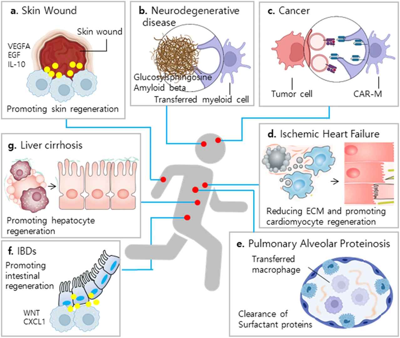 Macrophage-based Cell Therapy - Creative Diagnostics