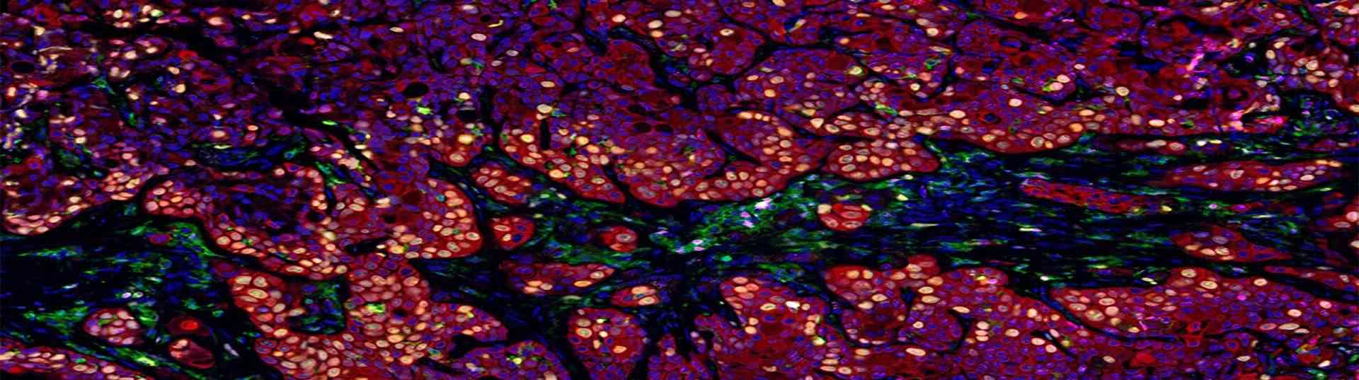 Magic-Fluor™ mIHC Staining Kits - Creative Diagnostics