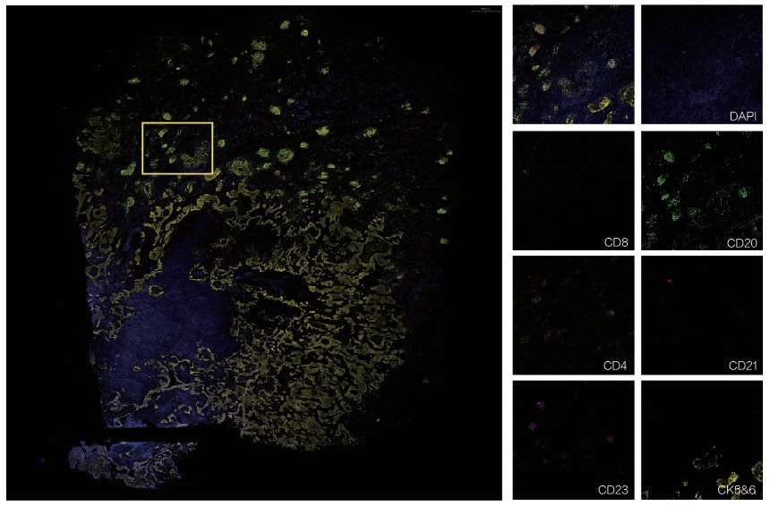 Magic-Fluor™ mIHC Staining Kits - Creative Diagnostics