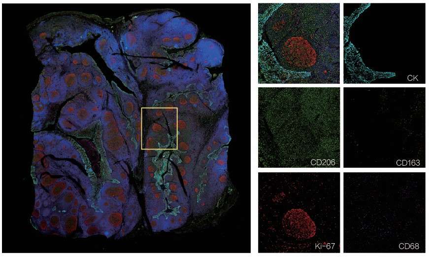 Magic-Fluor™ mIHC Staining Kits - Creative Diagnostics