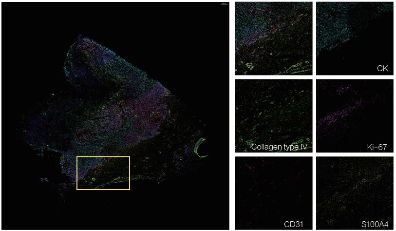 Magic-Fluor™ mIHC Staining Kits - Creative Diagnostics