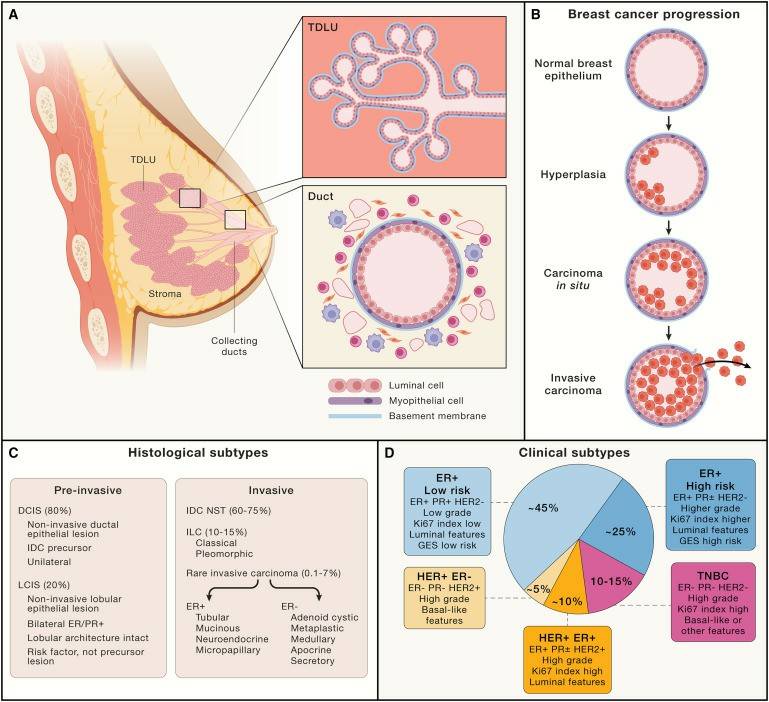 Main Tumor Markers in Human Breast Cancer - Creative Diagnostics