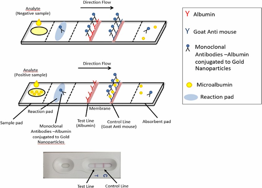 Micro-Albumin: Definition and Detection - Creative Diagnostics