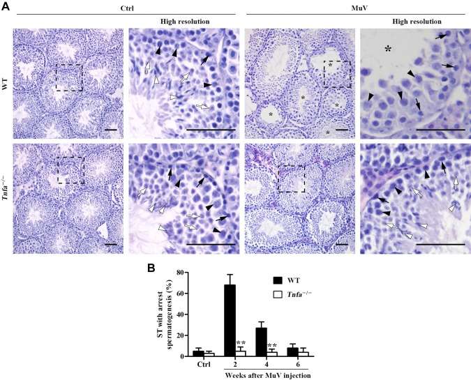 Mumps Virus (MuV) - Creative Diagnostics