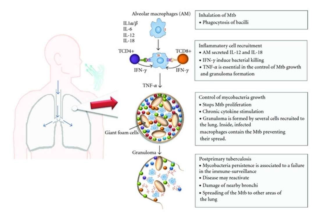 Mycobacterium tuberculosis (Mtb) and Immune Response - Creative Diagnostics