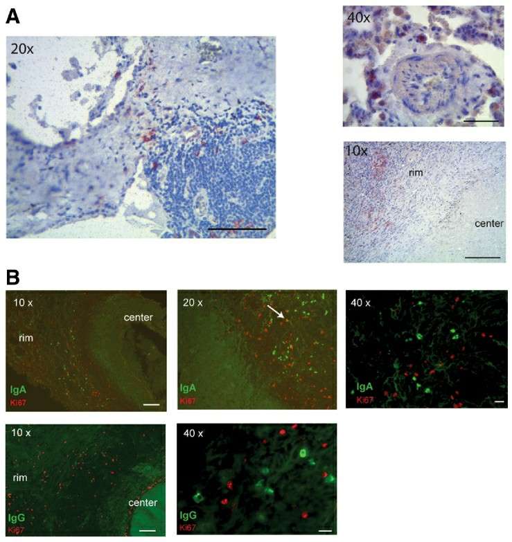 Mycobacterium tuberculosis (Mtb) and Immune Response - Creative Diagnostics