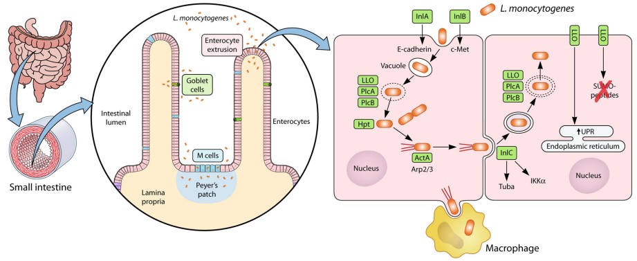 Pathogenicity of Listeria monocytogenes - Creative Diagnostics