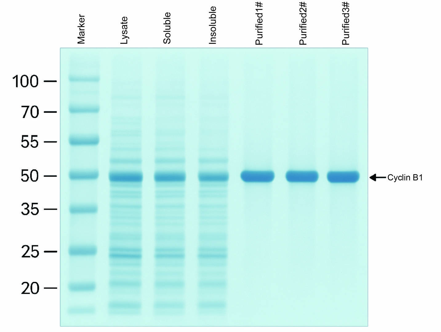Recombinant Antigen Expression Platform - Creative Diagnostics