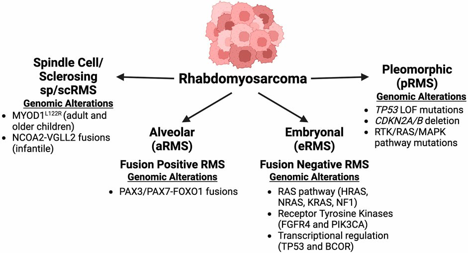 Rhabdomyosarcoma - Creative Diagnostics