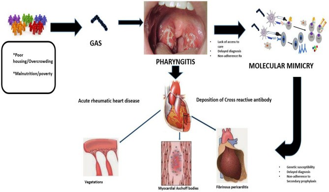 Rheumatic Disease ELISA Kits For Autoimmune Research - Creative Diagnostics