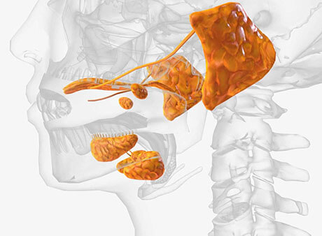 Salivary Gland Cancer - Creative Diagnostics