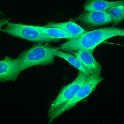 Secondary Antibodies - Creative Diagnostics