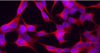 Secondary VHH Antibodies - Creative Diagnostics