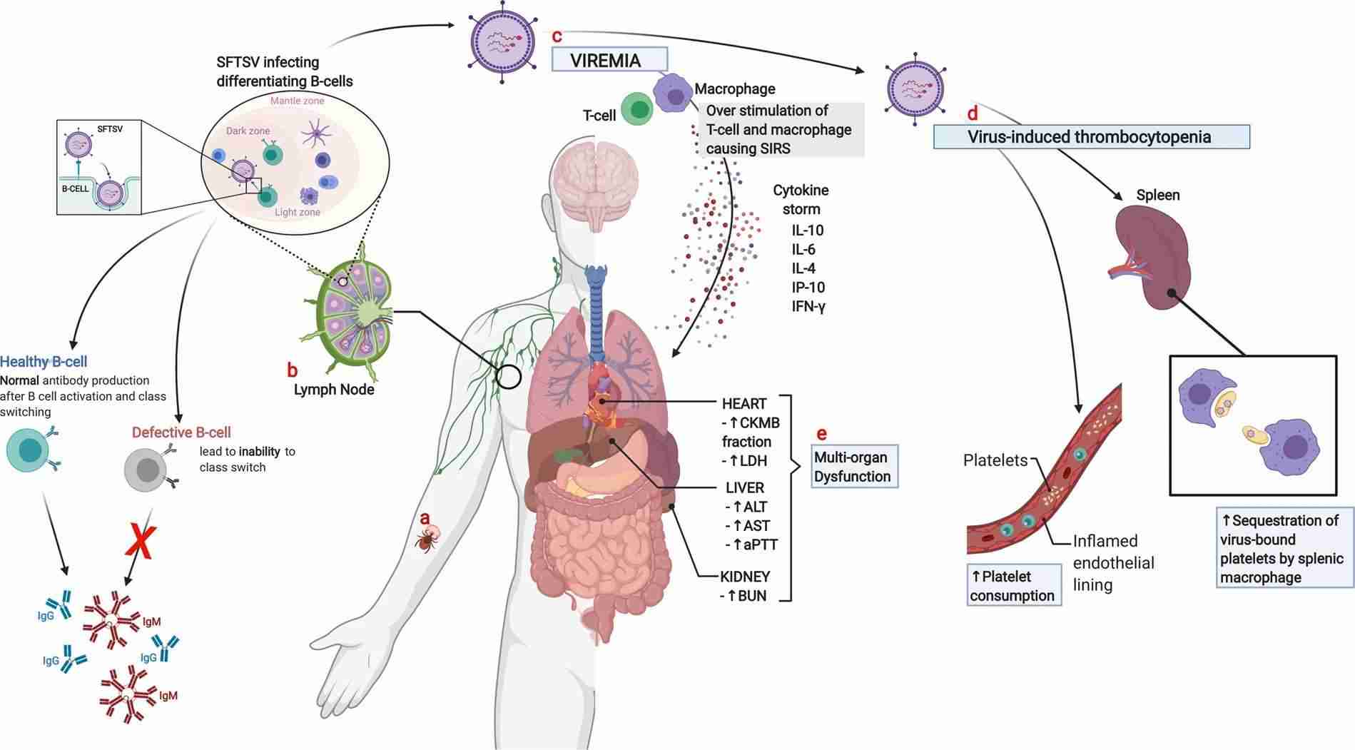 Severe Fever with Thrombocytopenia Syndrome - Creative Diagnostics