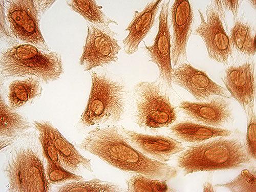 Specific Application FAQs - Creative Diagnostics