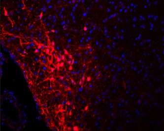 Tag Antibodies - Creative Diagnostics