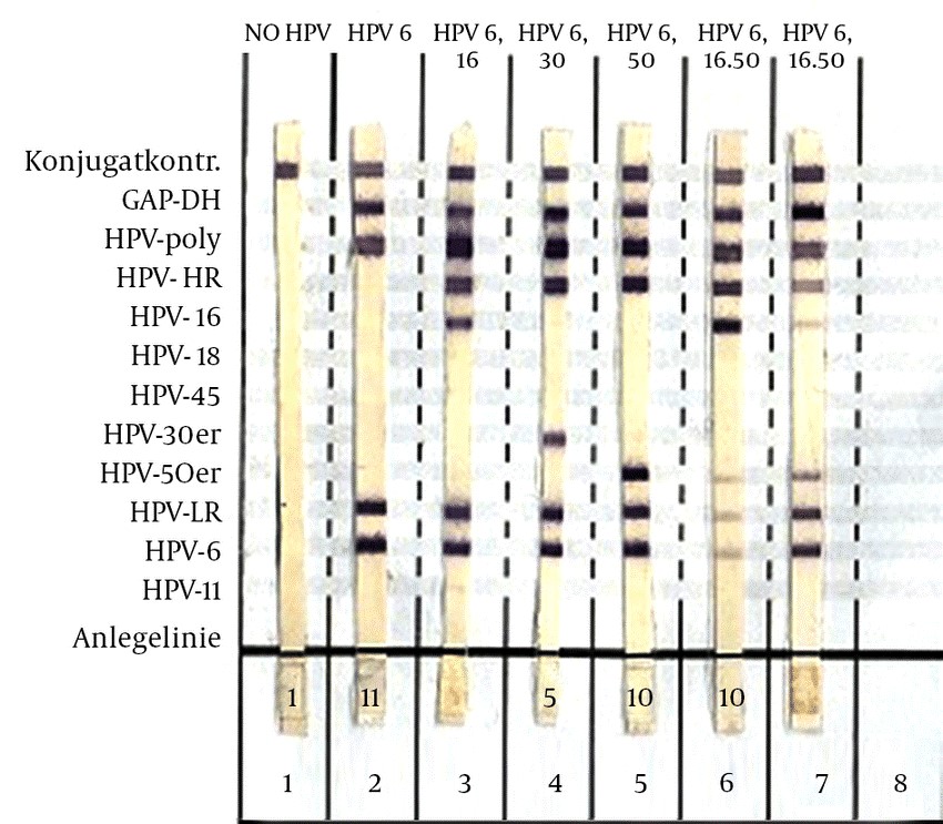 The Importance of HPV Typing Testing - Creative Diagnostics