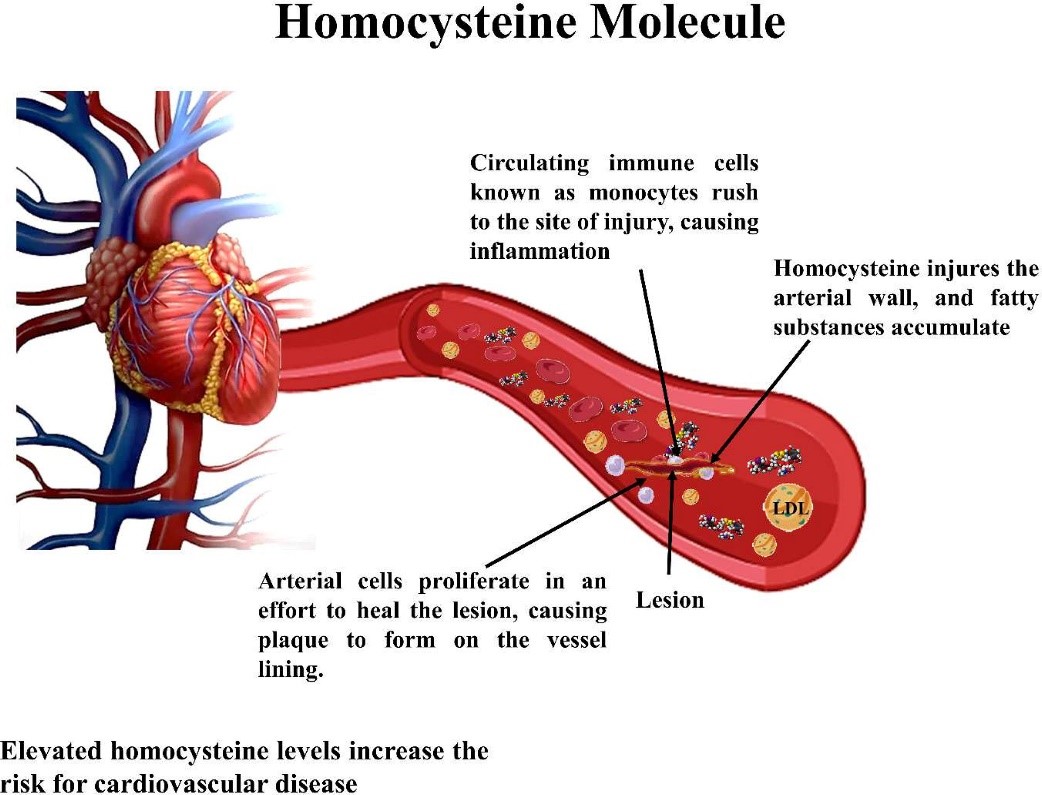 The Role of Homocysteine (Hcy) in Cardiovascular Disease - Creative Diagnostics