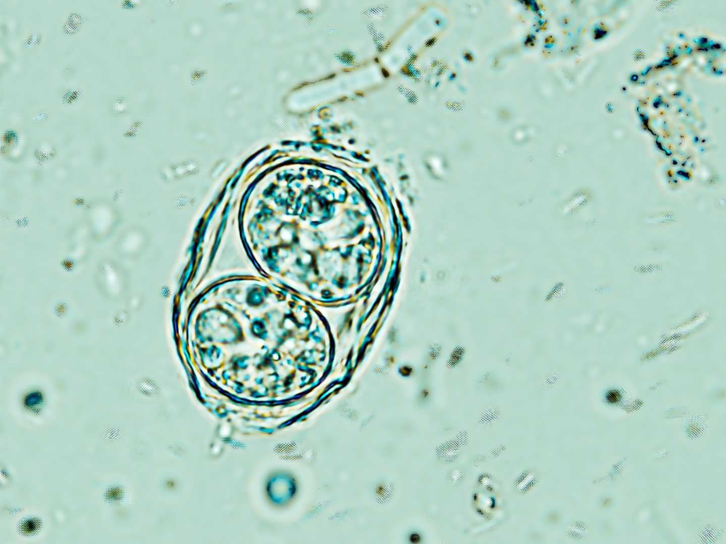 Toxoplasma gondii Life Cycle - Creative Diagnostics