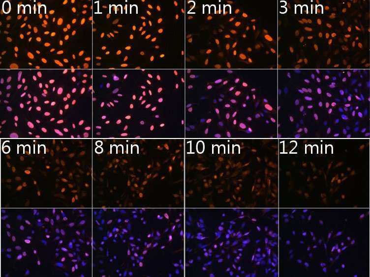 tRNA Modifications Detection - Creative Diagnostics