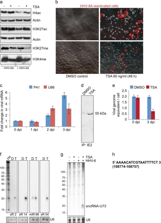 HHV-6: The Mysterious Virus, a Potential Threat - Creative Diagnostics