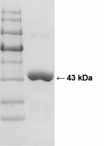 Vector-Borne Disease Recombinant Proteins - Creative Diagnostics