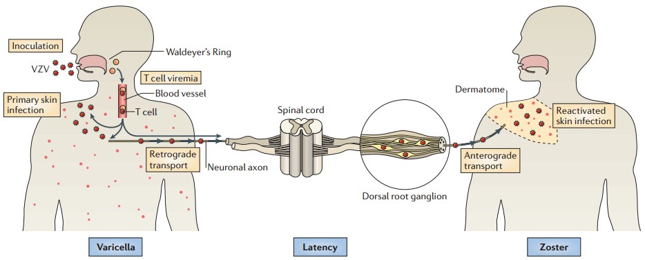 VZV Infection and Immunization Strategies - Creative Diagnostics