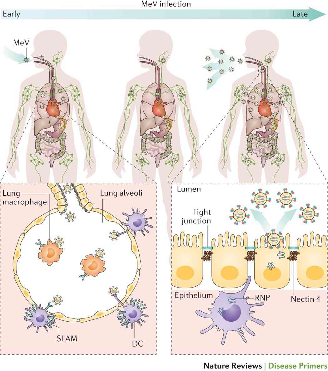 What is Measles Virus - Creative Diagnostics